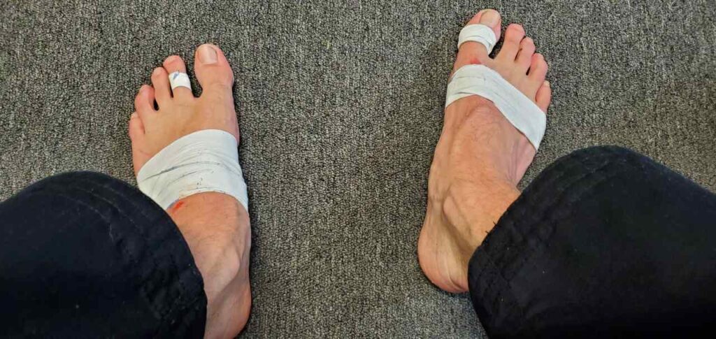 Mat Burn in Brazilian Jiu Jitsu (BJJ): Prevention and Treatment